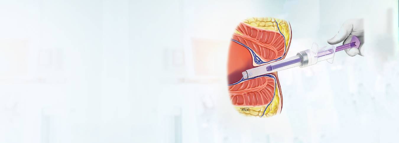 Best Rubber Band Ligation Treatment for Piles in Thrissur - Dr Raviram S